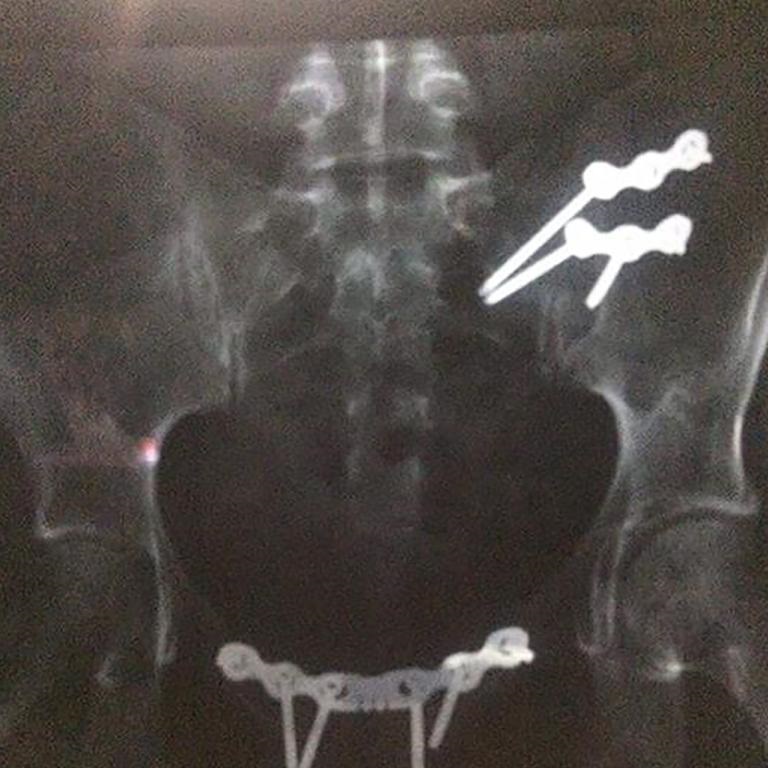 Jockey sues insurers and Racing Australia over racing fall at Doomben ...